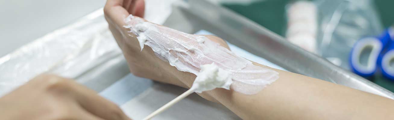 Burn Injury Long Term Effects | After a Burn Injury